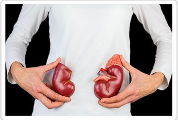 A New Technique for Preserving Kidney Grafts - International Society of ...